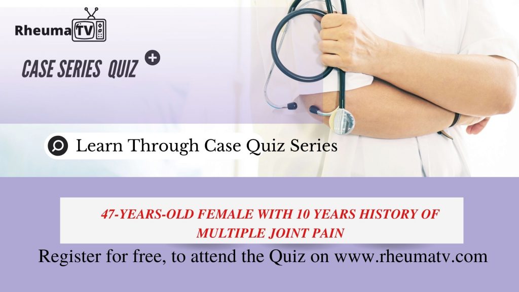 47-years-old Female with 10 years history of multiple joint pain - 20 ...